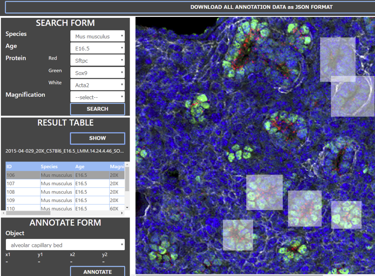 Digital Pathology Using Deep Learning – Mie University Image Processing ...